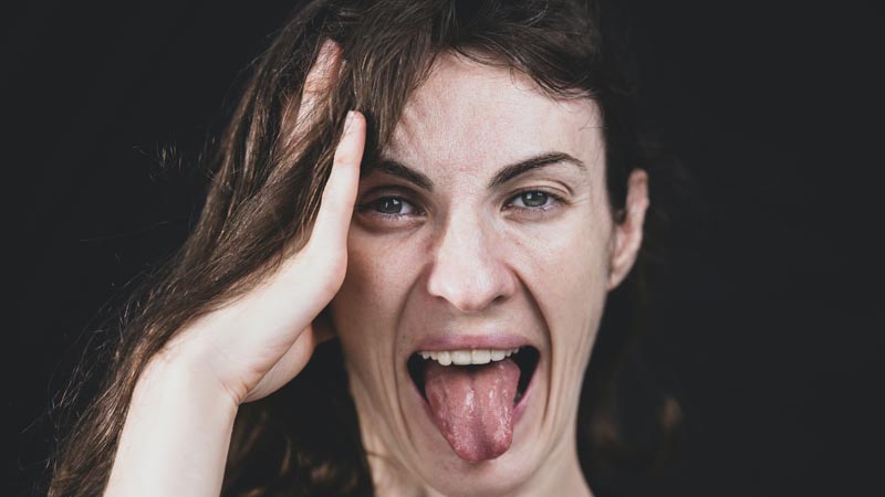 COVID tongue is real: Here's how to treat it | MDLinx