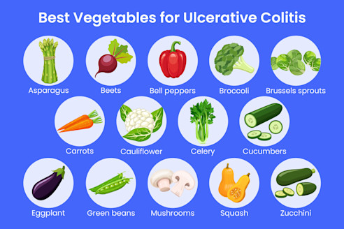 Safe Vegetable Options for Ulcerative Colitis Patients