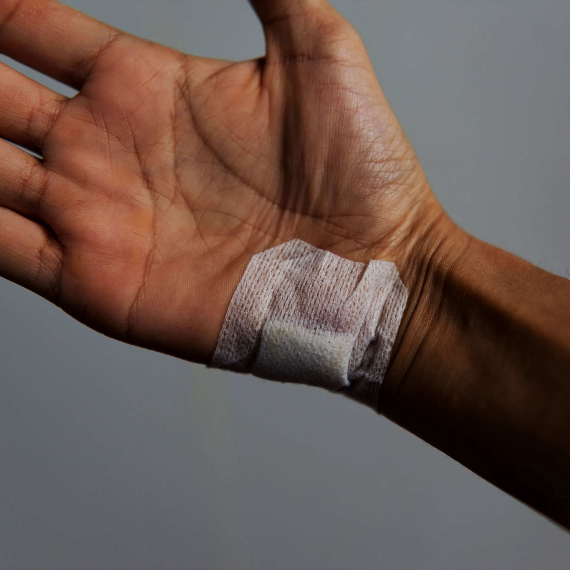 How Smoking Impacts the Skin