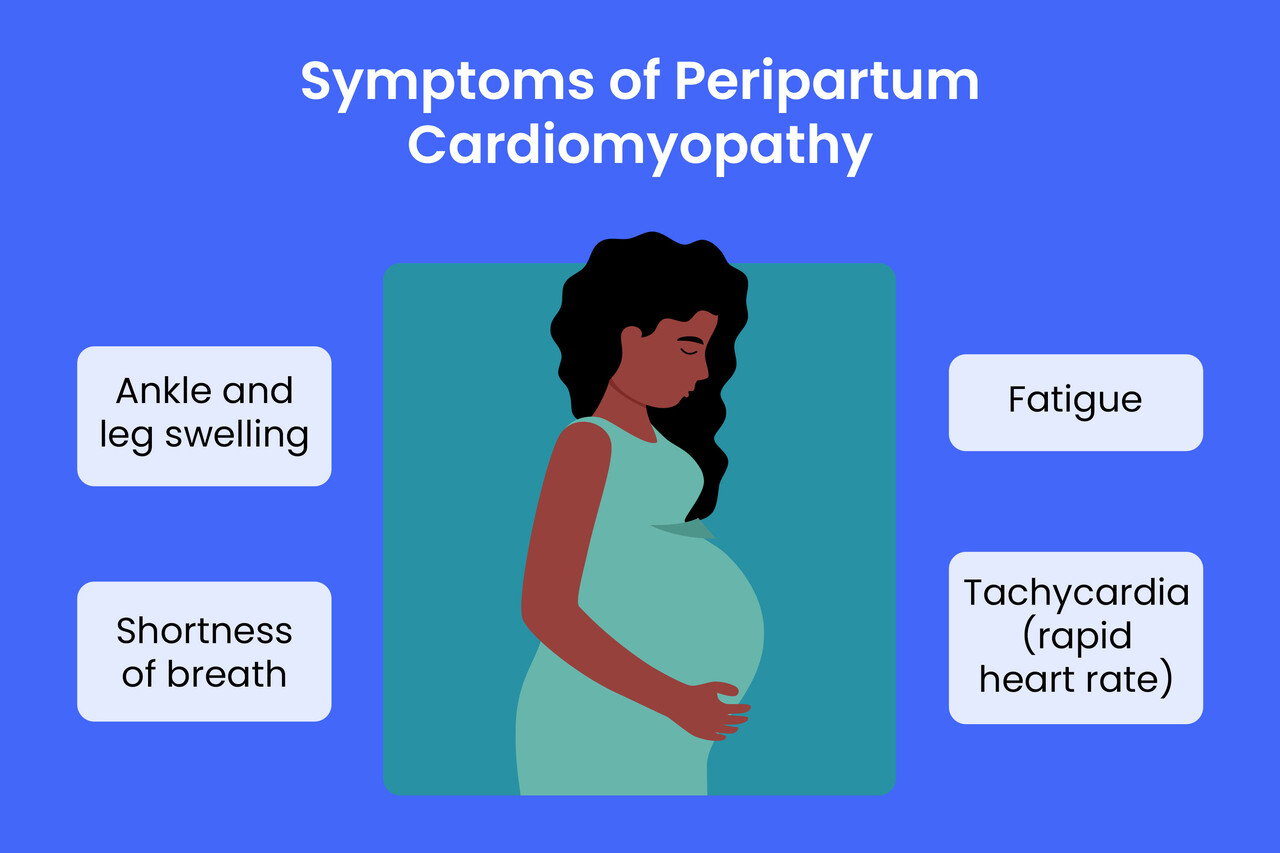 Peripartum Cardiomyopathy: Symptoms, Treatment and More