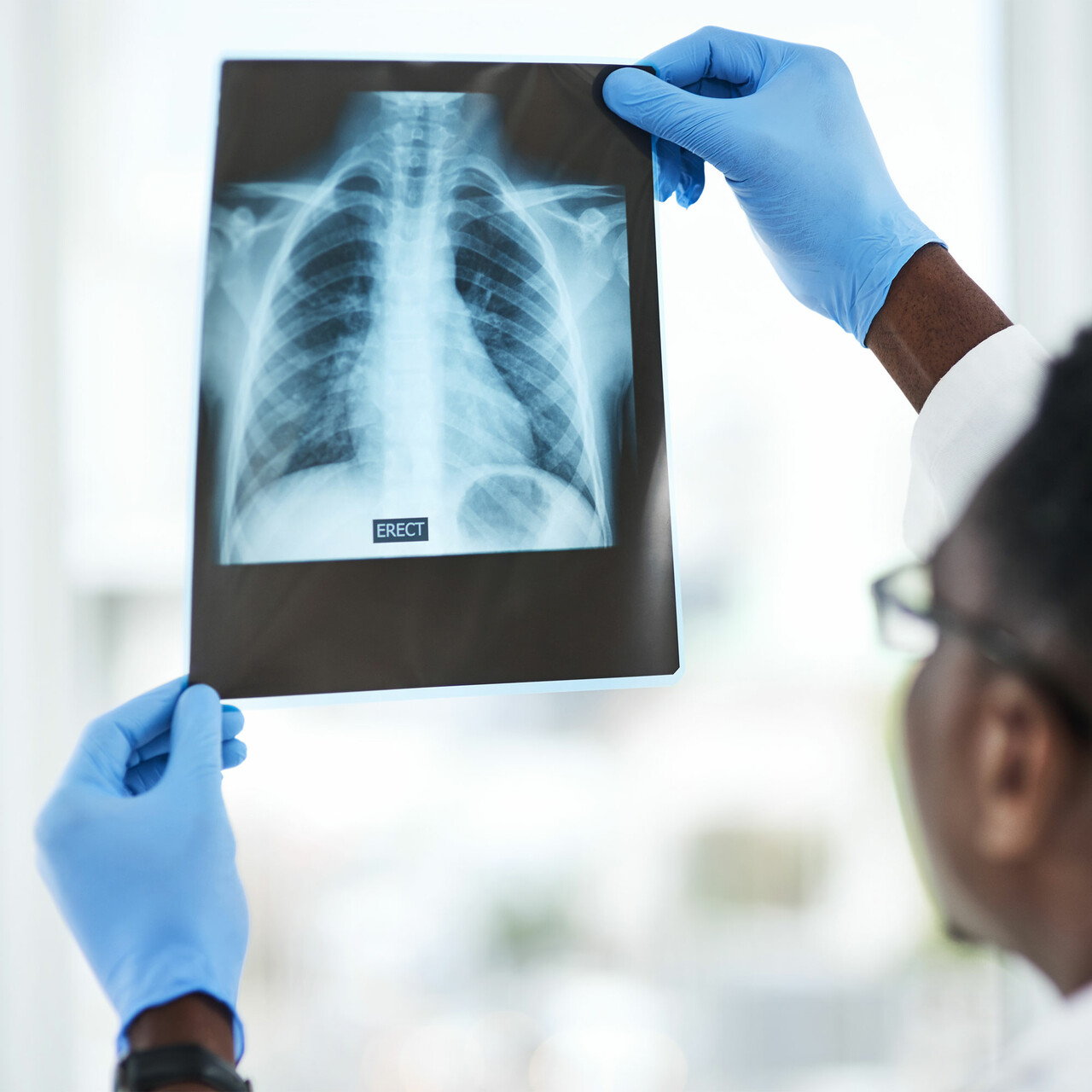 What to Know About RA and Cancer Risk