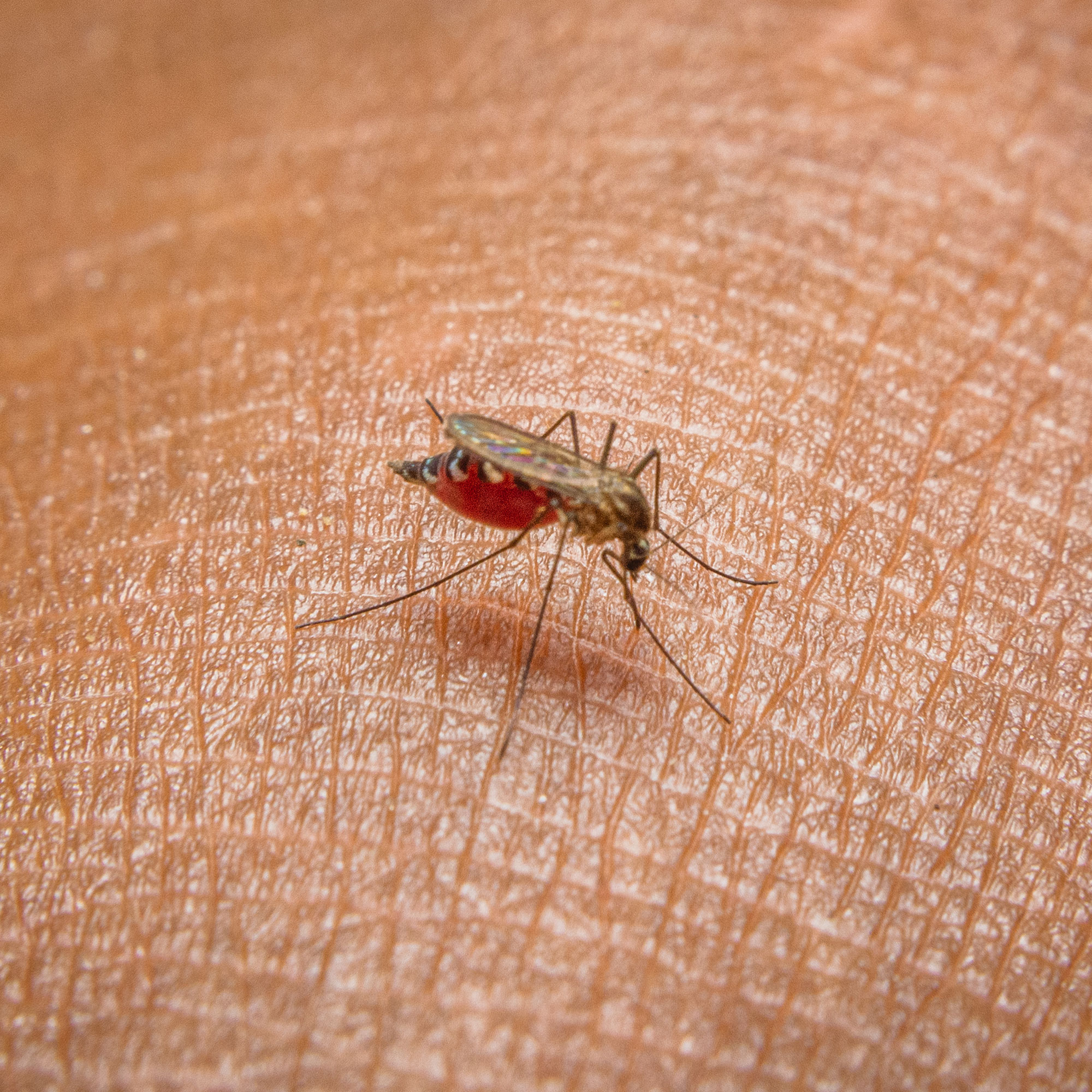 African Americans and Sickle Cell Disease