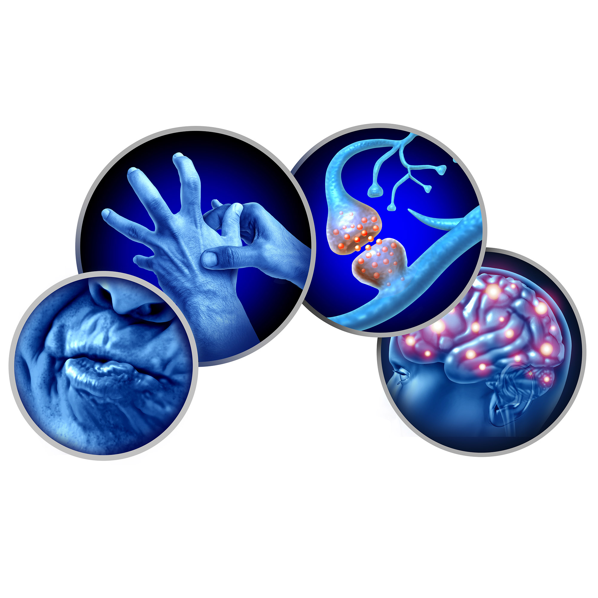 How Antipsychotics Lead to Tardive Dyskinesia