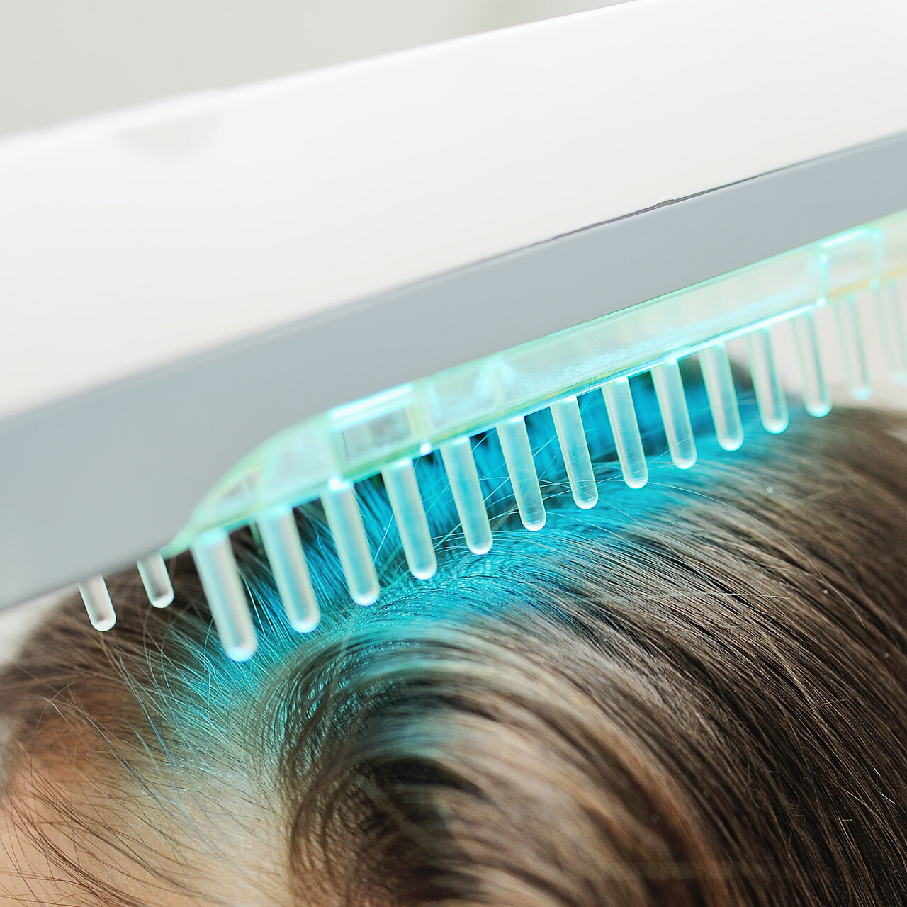 Understanding Light Therapy for Scalp Psoriasis