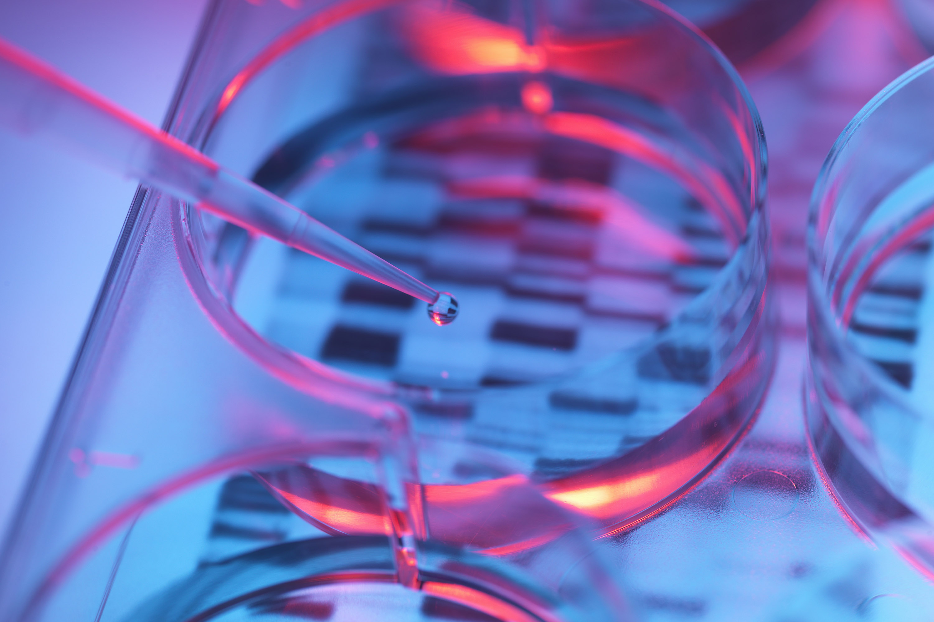 Can a New Test Predict Which People With IBD Will Develop Bowel Cancer?