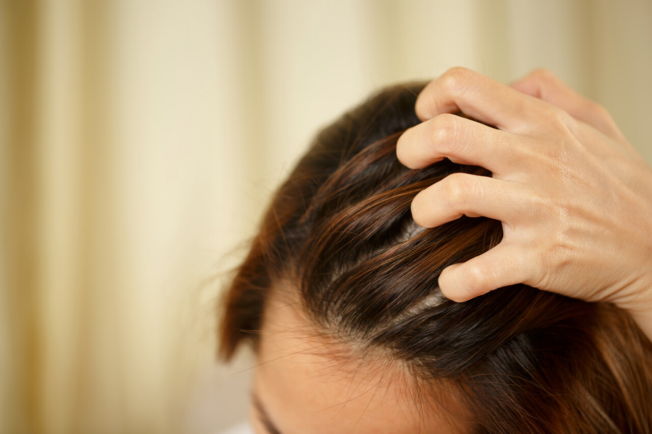 Understanding Light Therapy for Scalp Psoriasis