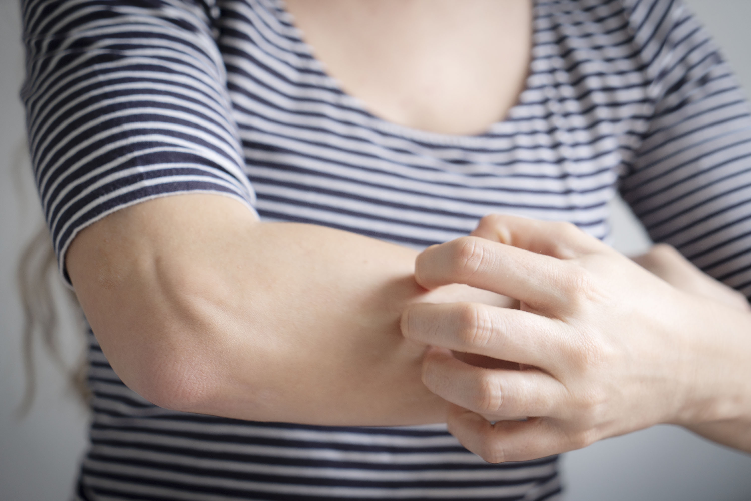 New Research Offers Clues on Why Eczema Causes Your Skin to Itch