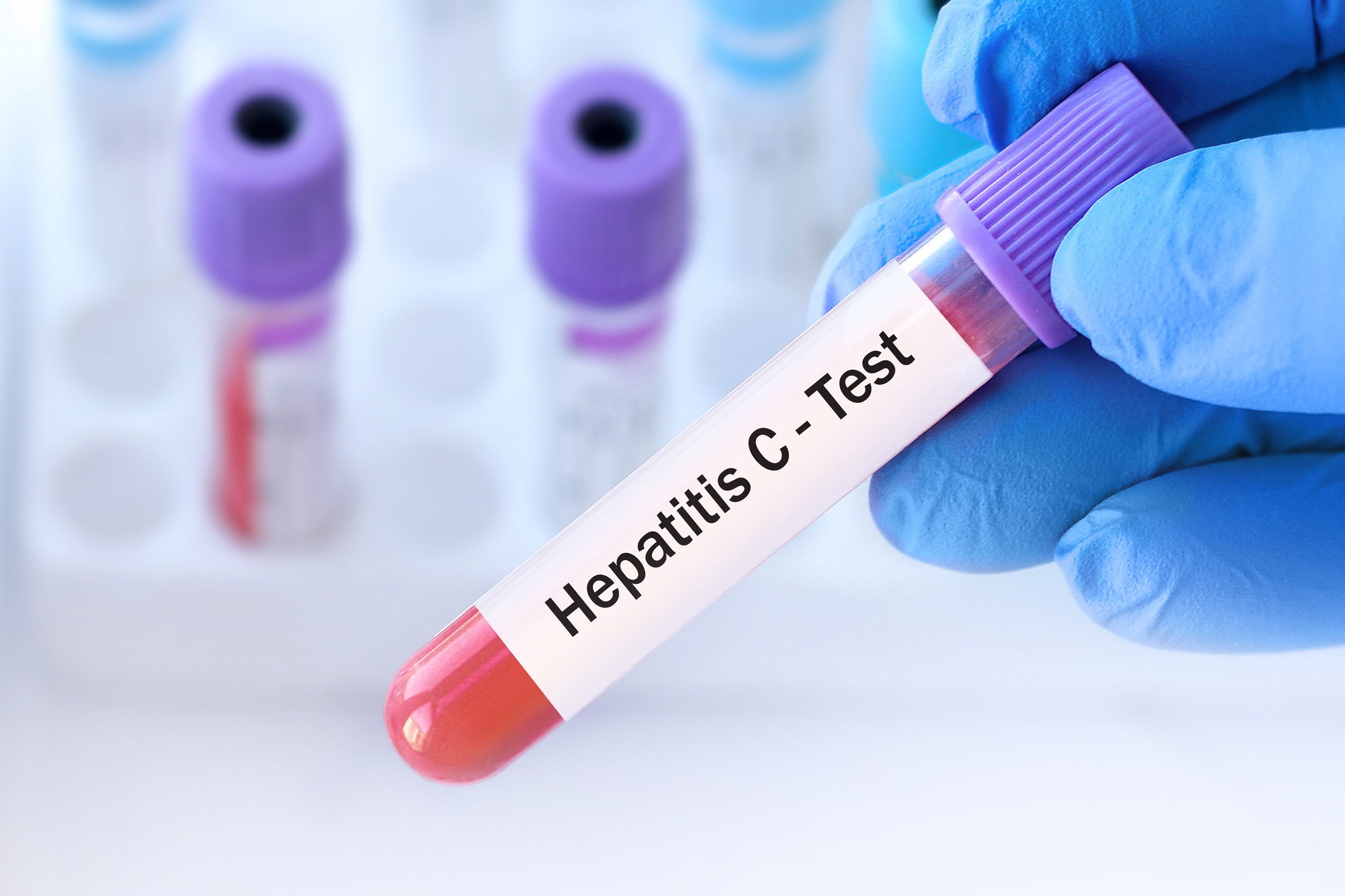 Everything You Need to Know About Hepatitis C Genotypes
