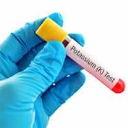 High Potassium In Blood Test Here s What It Means