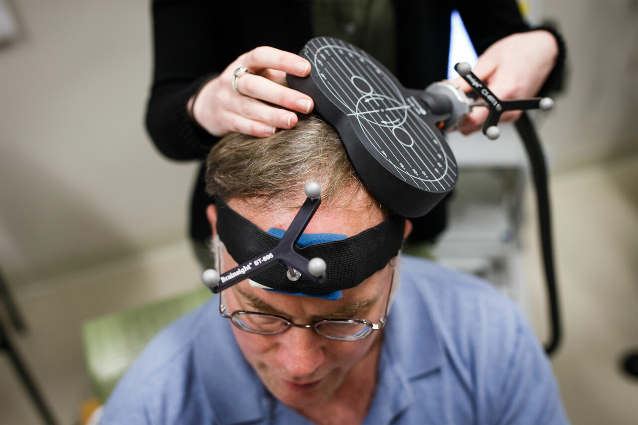 Non-Invasive Brain Stimulation for MS