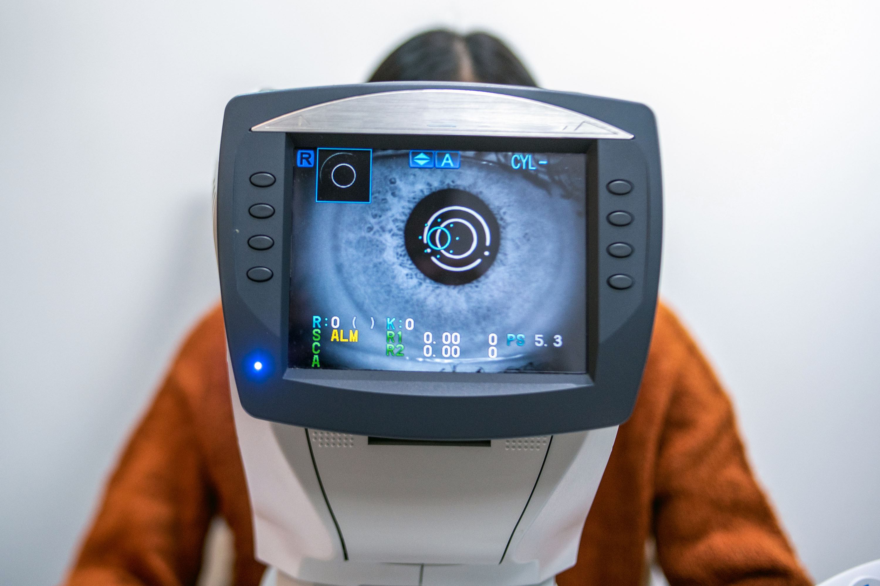Diabetic Retinopathy Is Far More Prevalent Than Previously Thought
