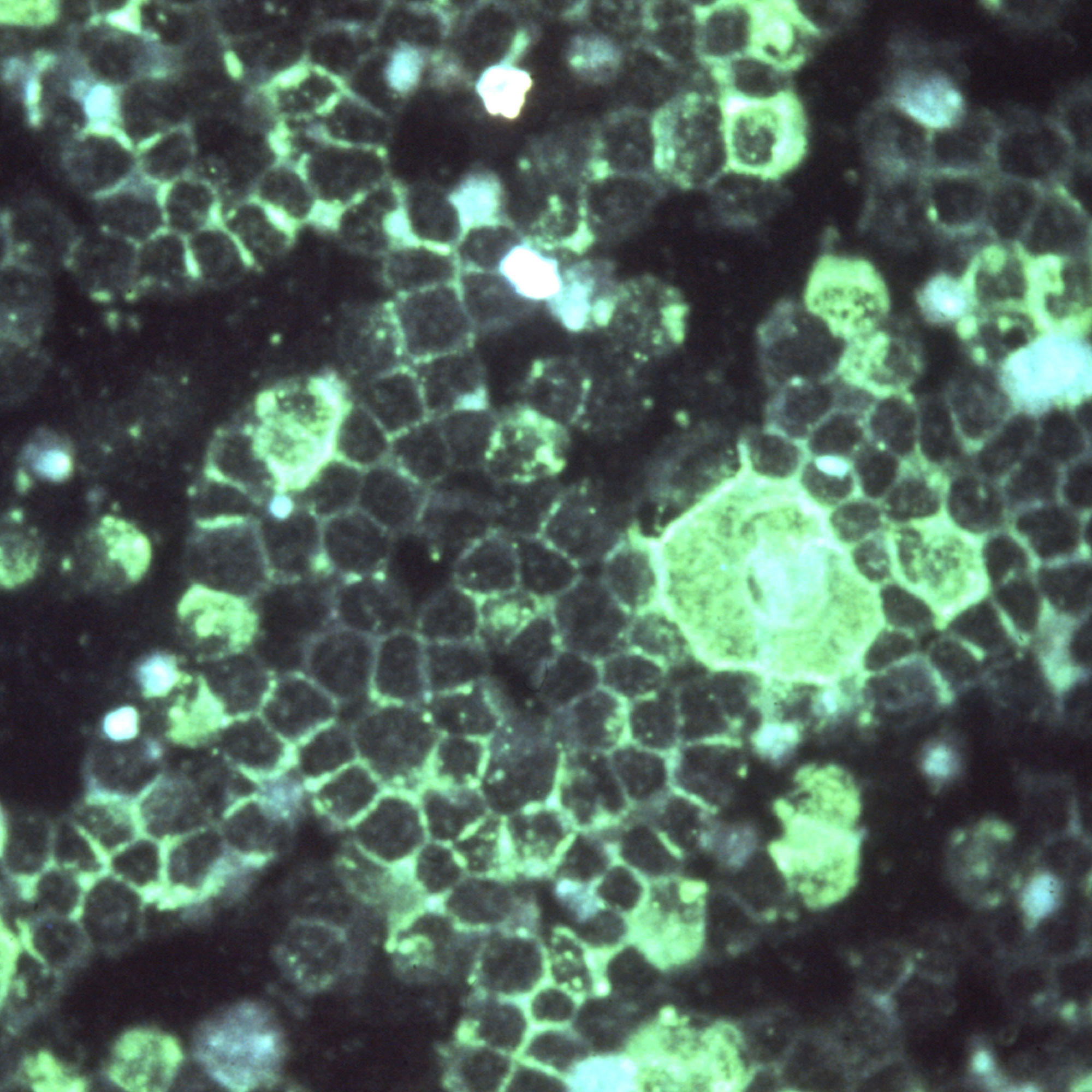 These Are Your Lungs on RSV