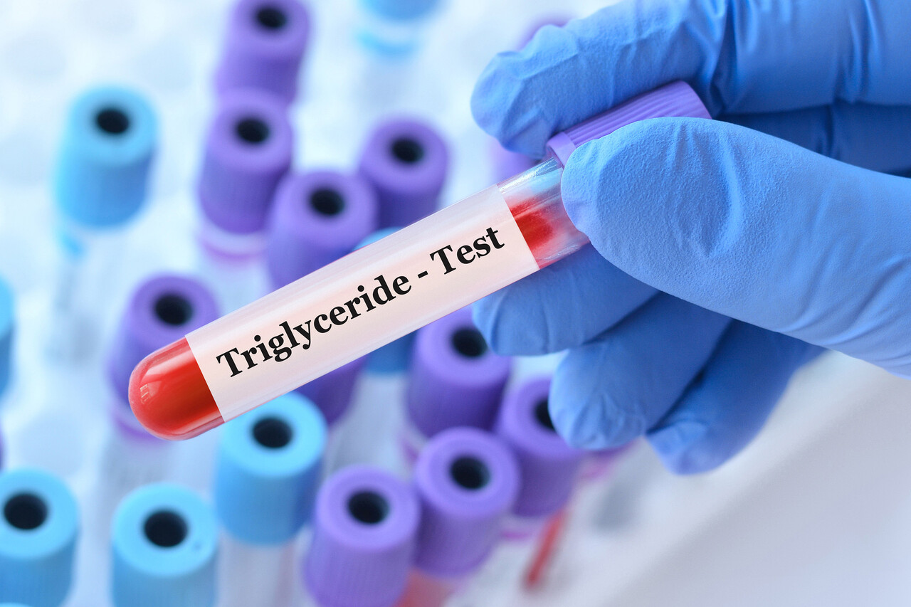 What Is VLDL (Very Low-Density Lipoprotein)?