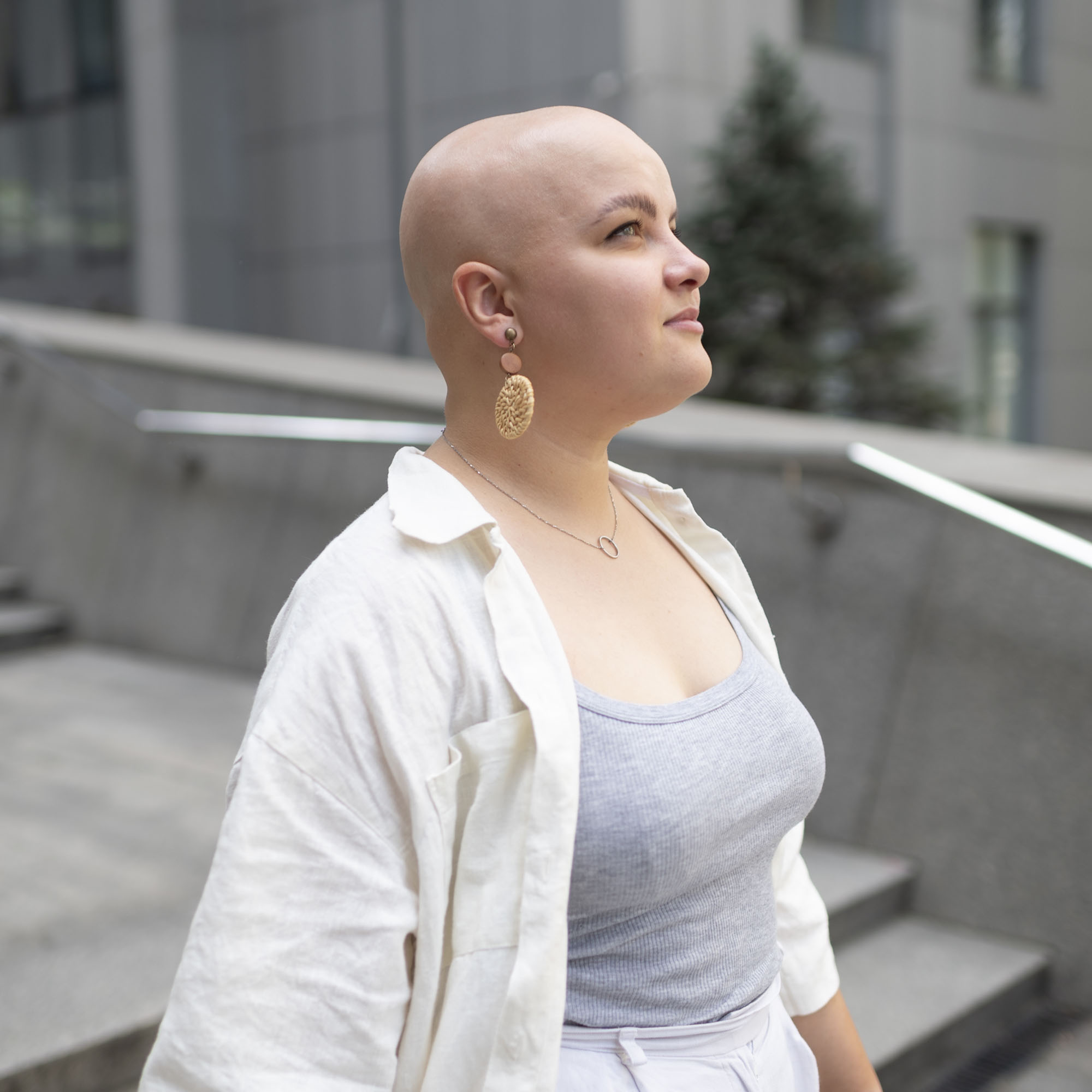 How People With Alopecia Get Through the Hard Days