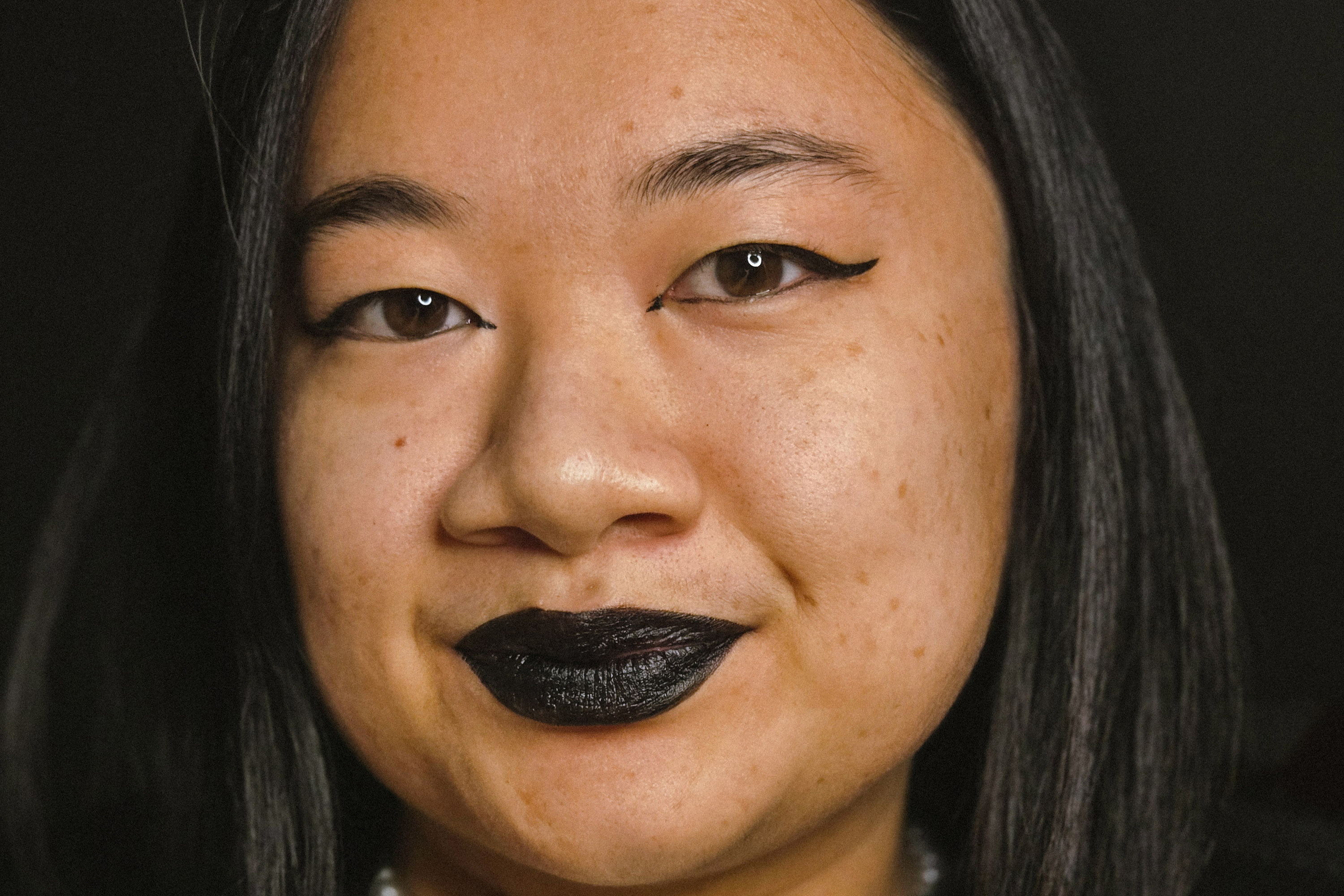 Alina Vue’s Journey With Psoriasis and Psoriatic Arthritis