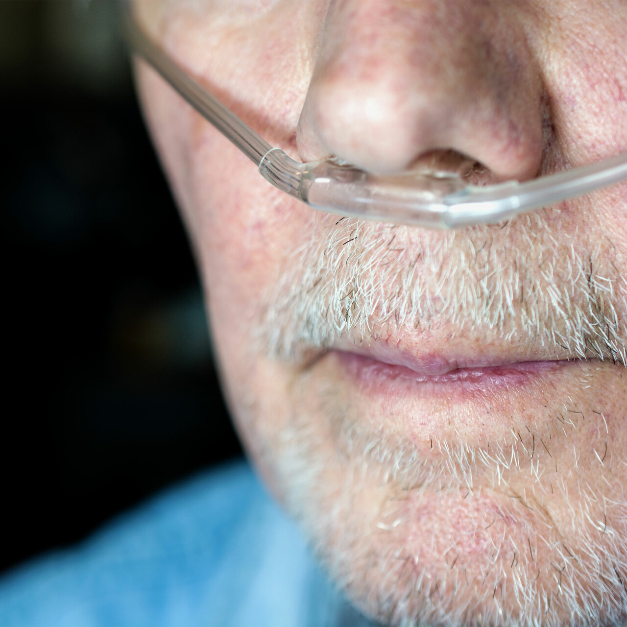 Is Endobronchial Valve Placement for COPD Right for You?