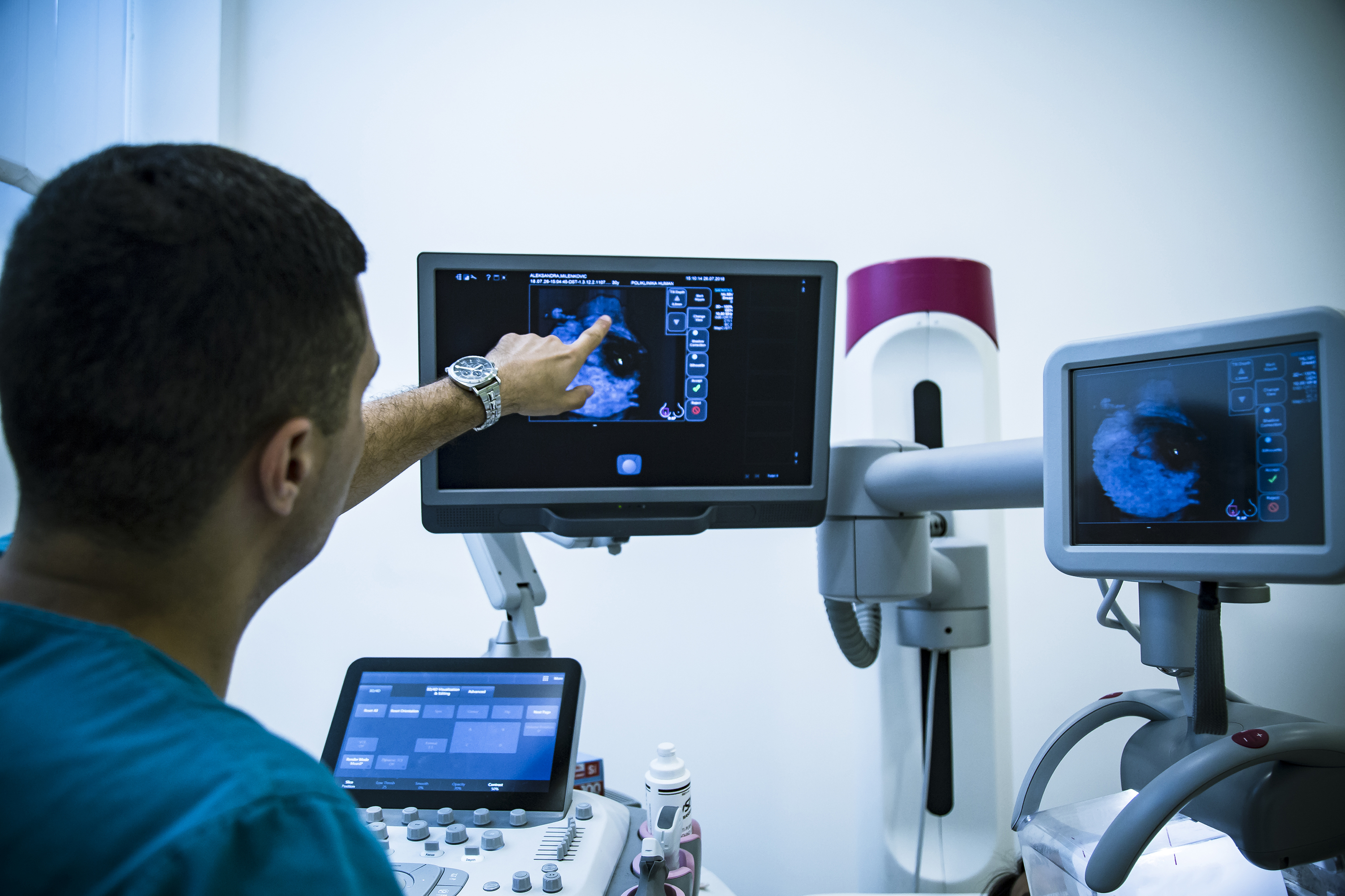 Pseudoangiomatous Stromal Hyperplasia (PASH)