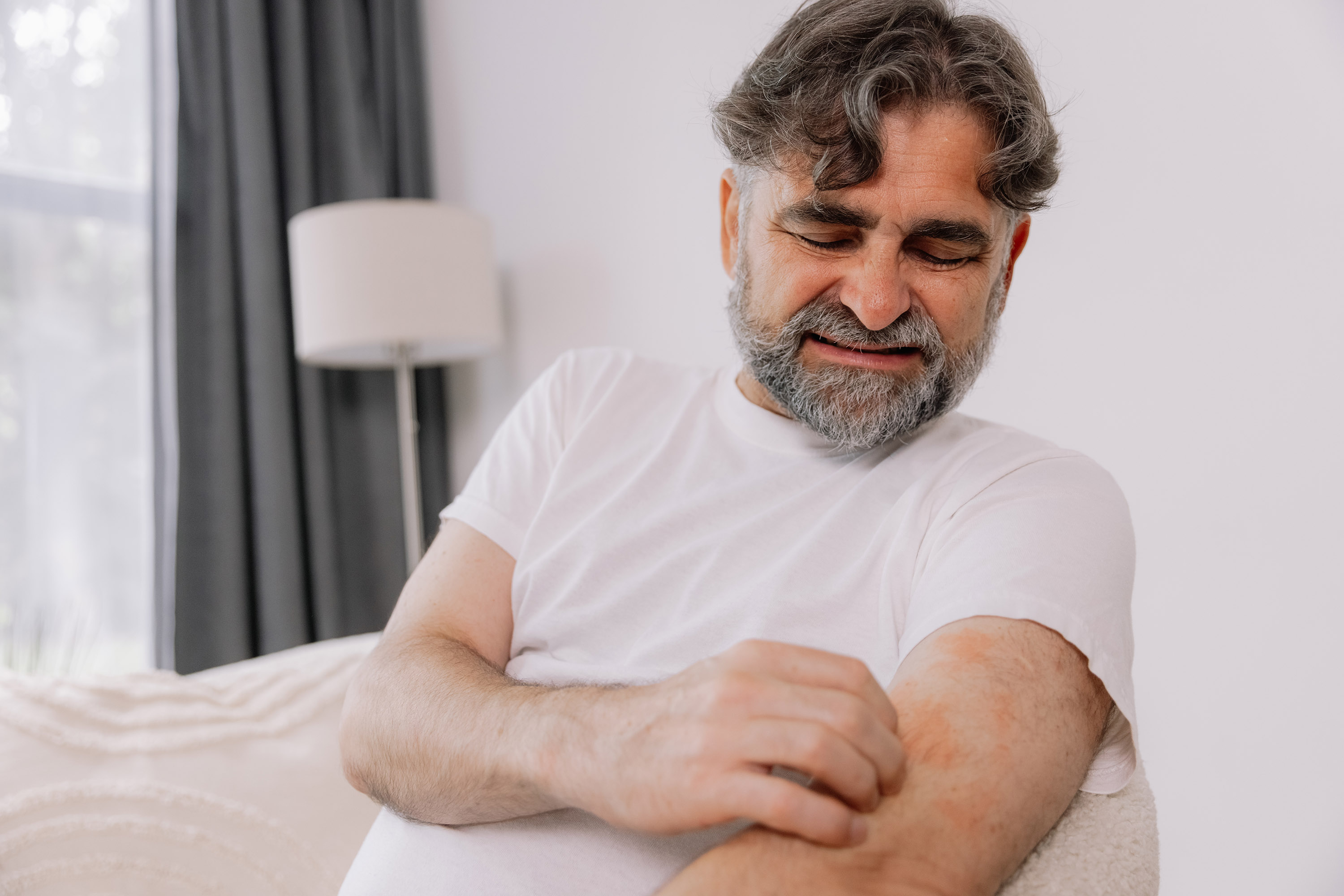 Topical Steroid Withdrawal: New Research and Treatment Clues
