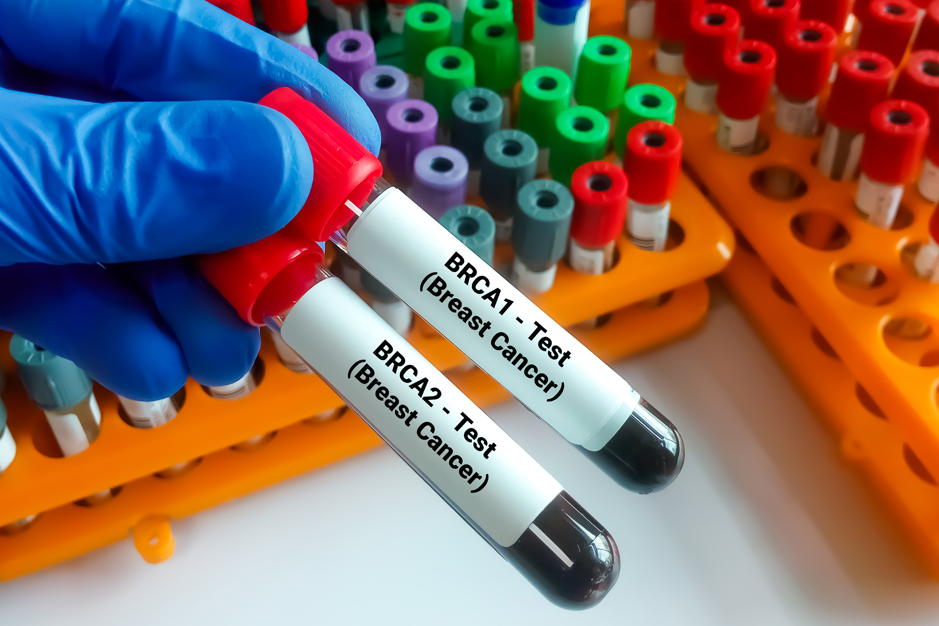 Breast Cancer Genetic Testing Cost: Is It Worth It?