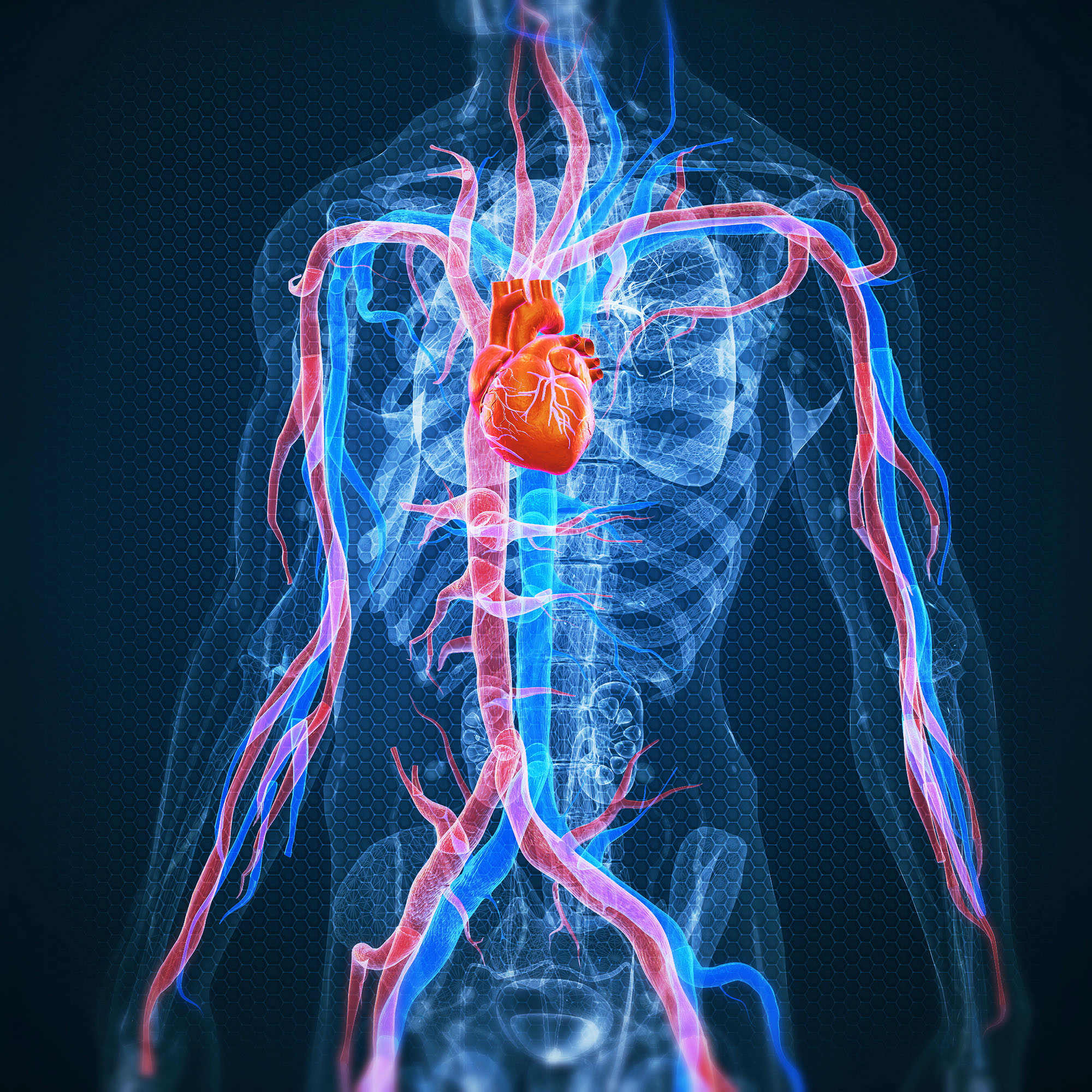 Can You Improve Exercise Intolerance From HCM With Medication?