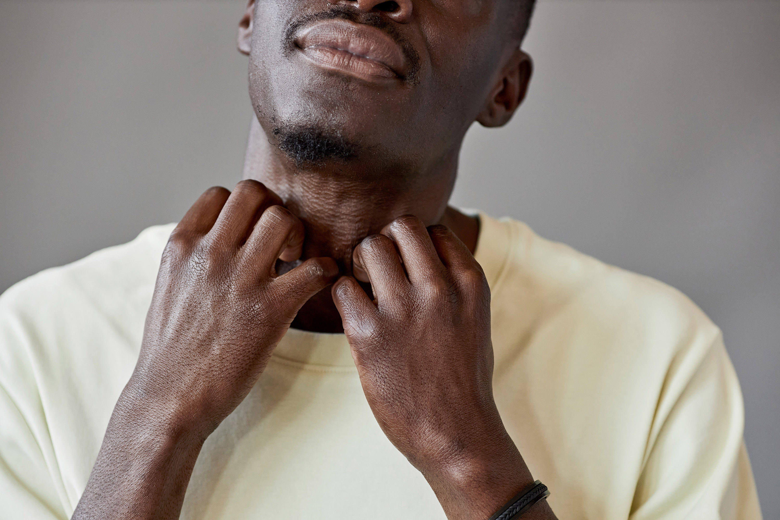 Here’s How Eczema Differs in People of Color