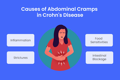 Crohn’s Cramps: Causes, Symptoms, and Treatment Options