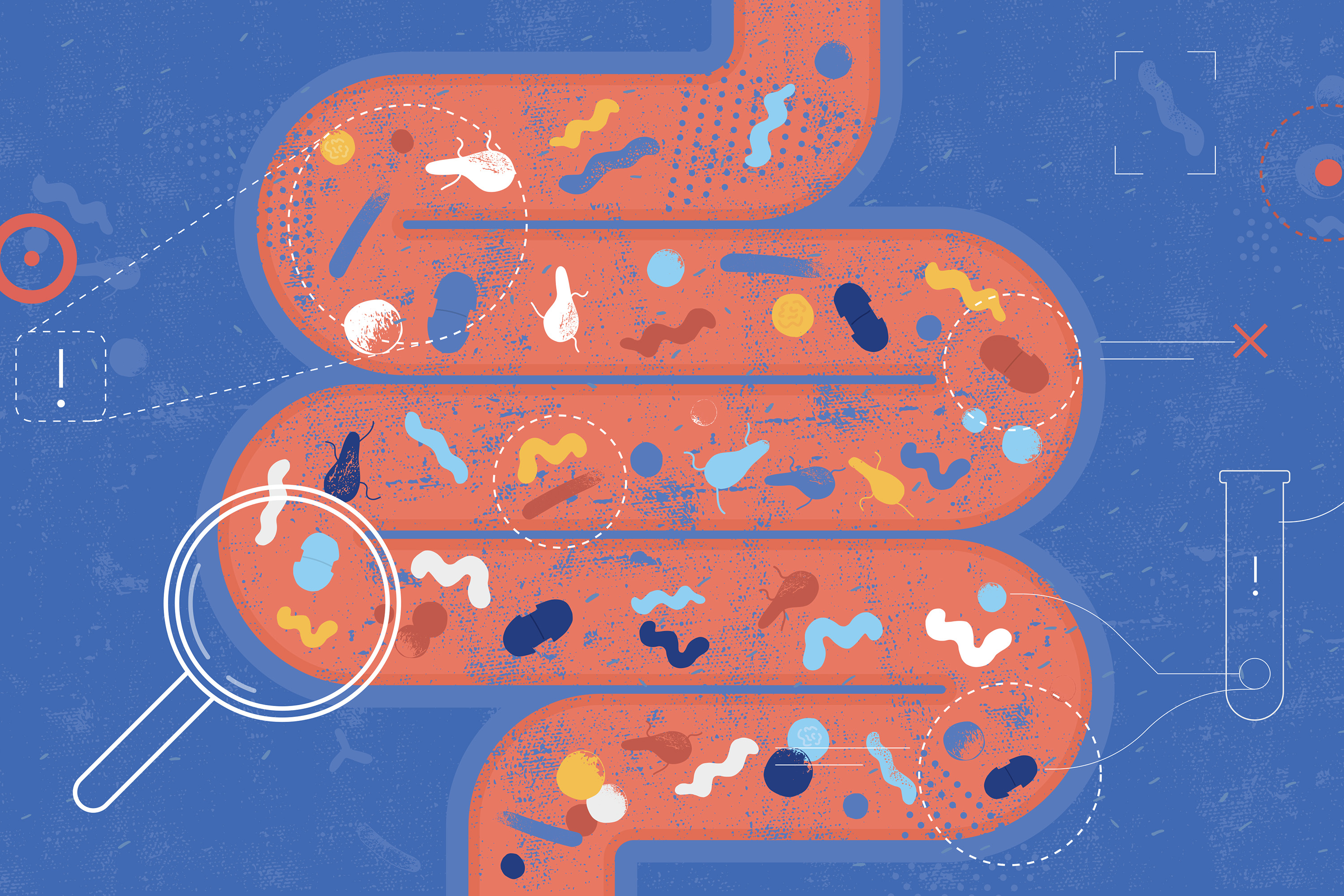 The Gut Microbiome, Hunger, and Different Types of Obesity