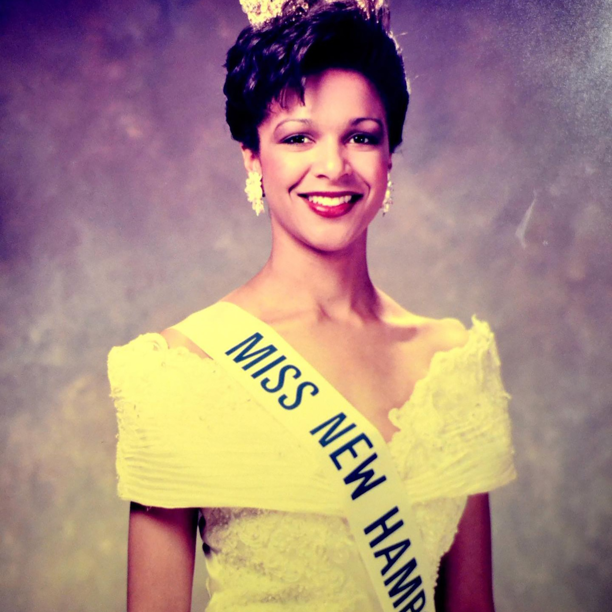 A Dancer Learns to Live With Multiple Sclerosis