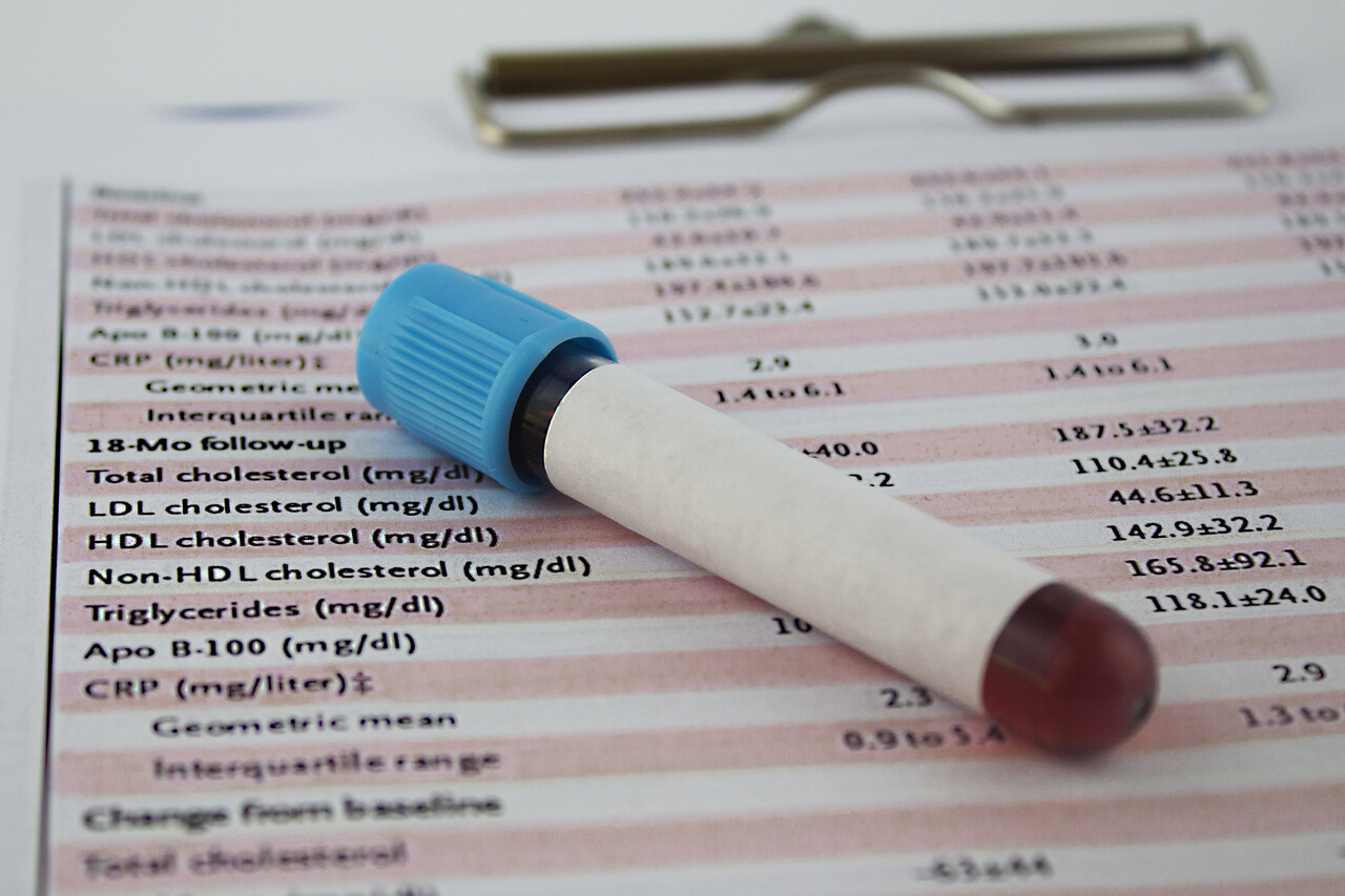 Can HDL Cholesterol Be Too High?