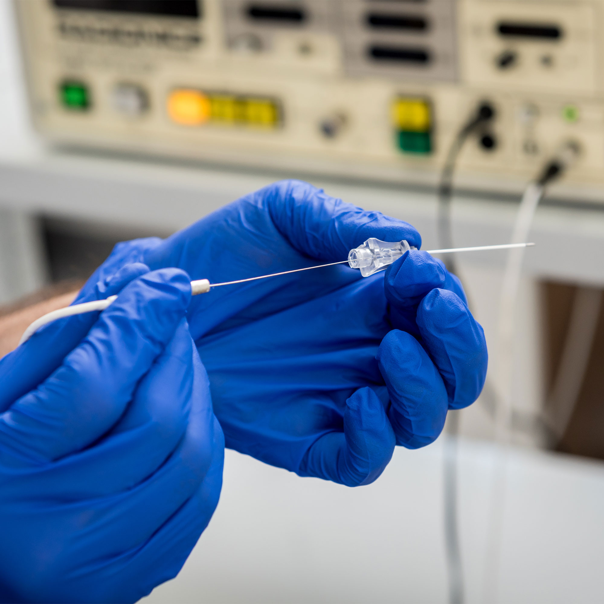 The Latest Minimally-Invasive Fibroid Procedures