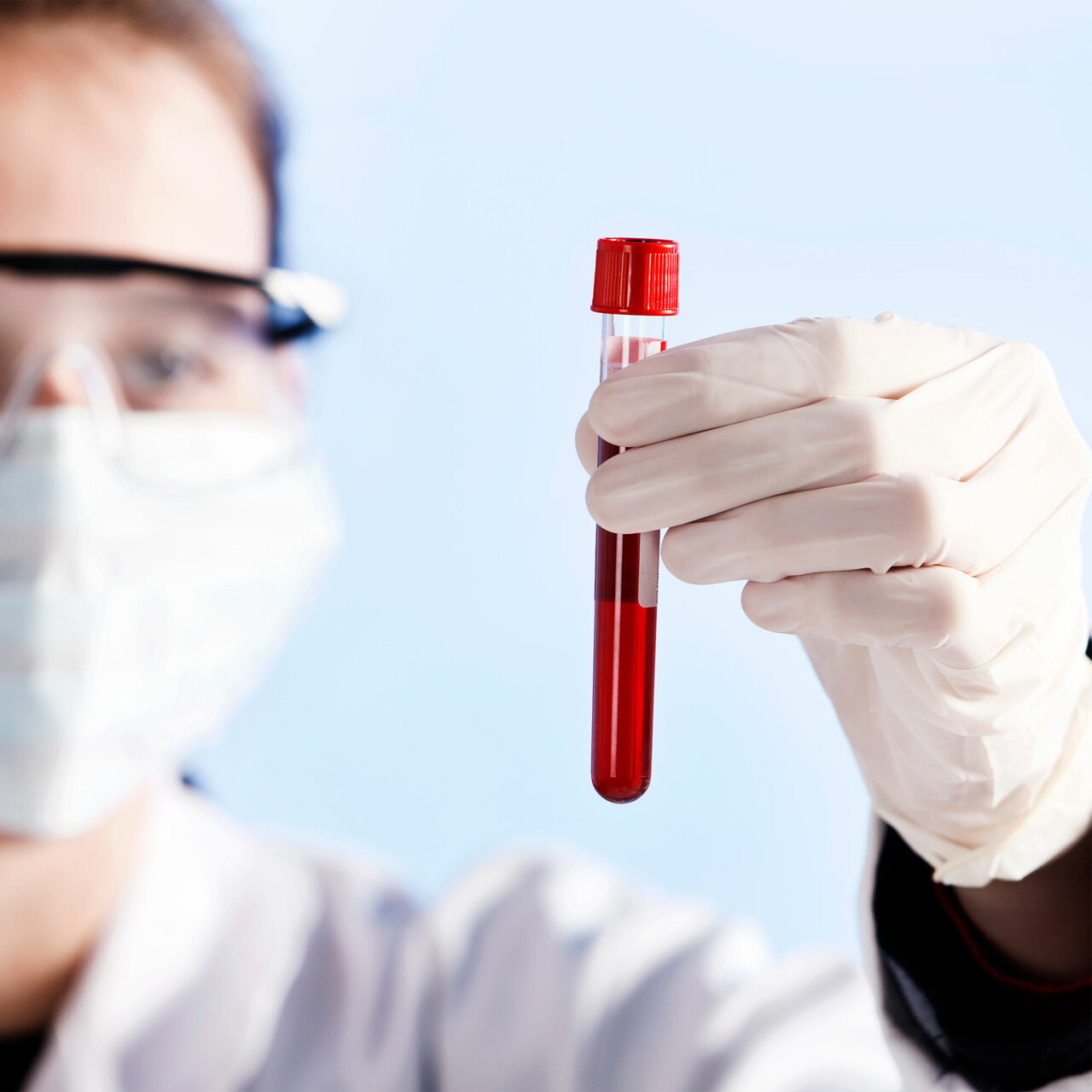 9 Things People With Kidney Disease Need to Know About Hyperkalemia