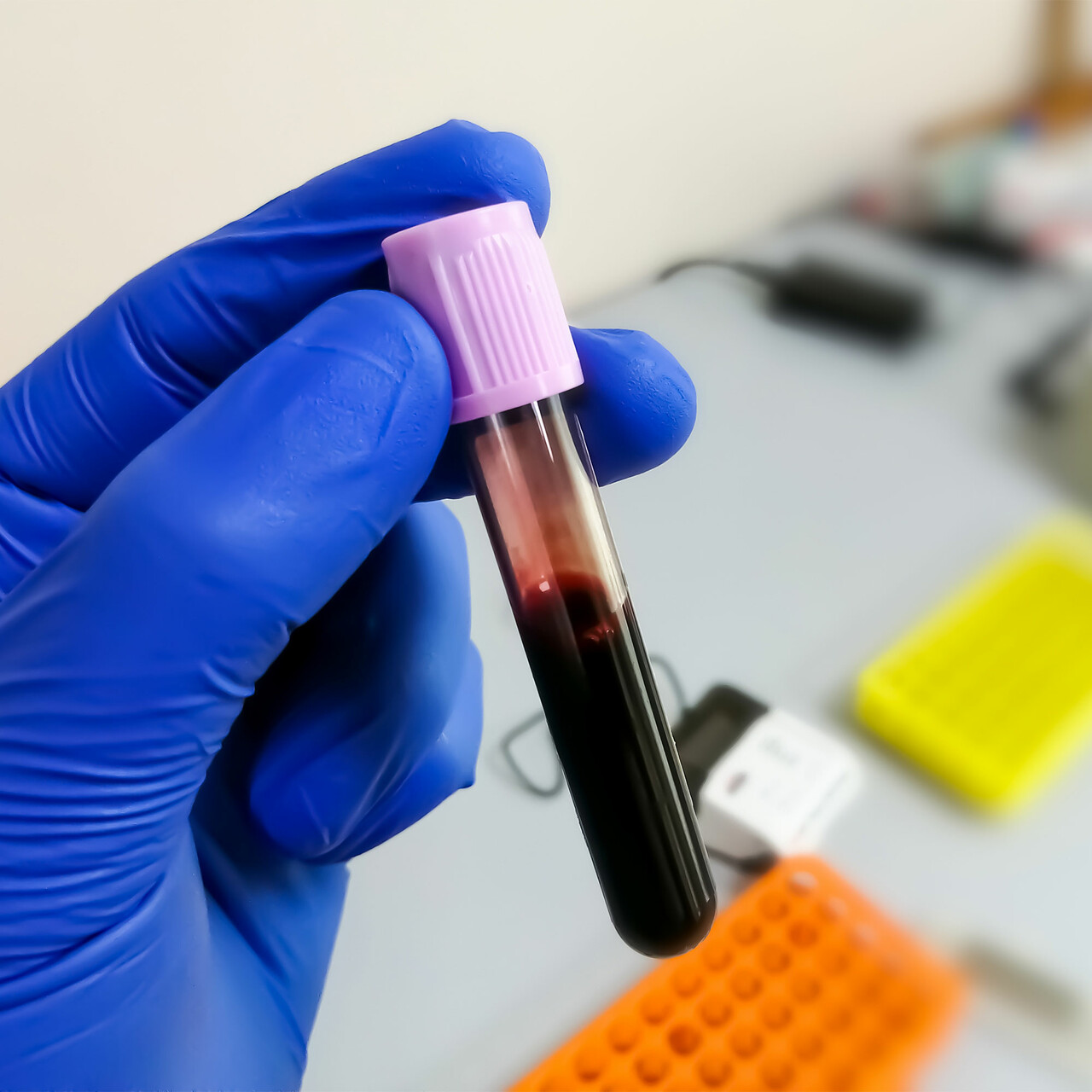 The Latest Thinking on Lupus Treatment