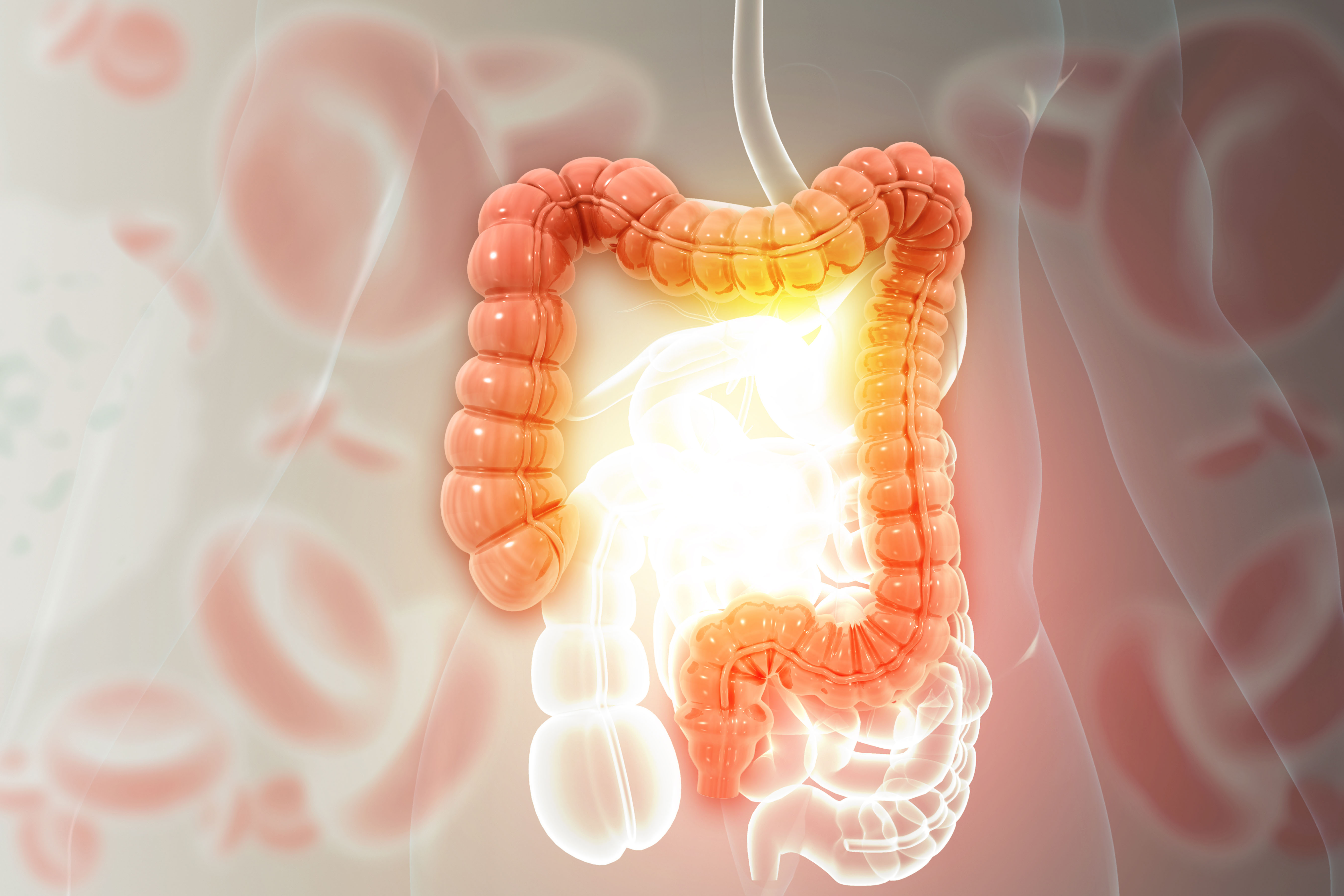 Have Researchers Found the Immune Trigger That Drives Higher Colon ...