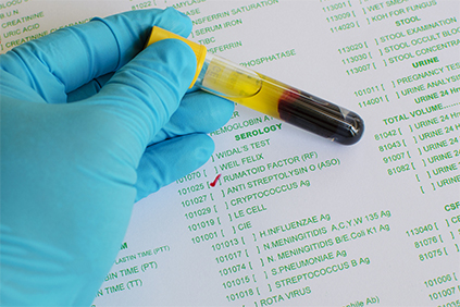 Is it Psoriatic Arthritis or Rheumatoid Arthritis? | HealthCentral