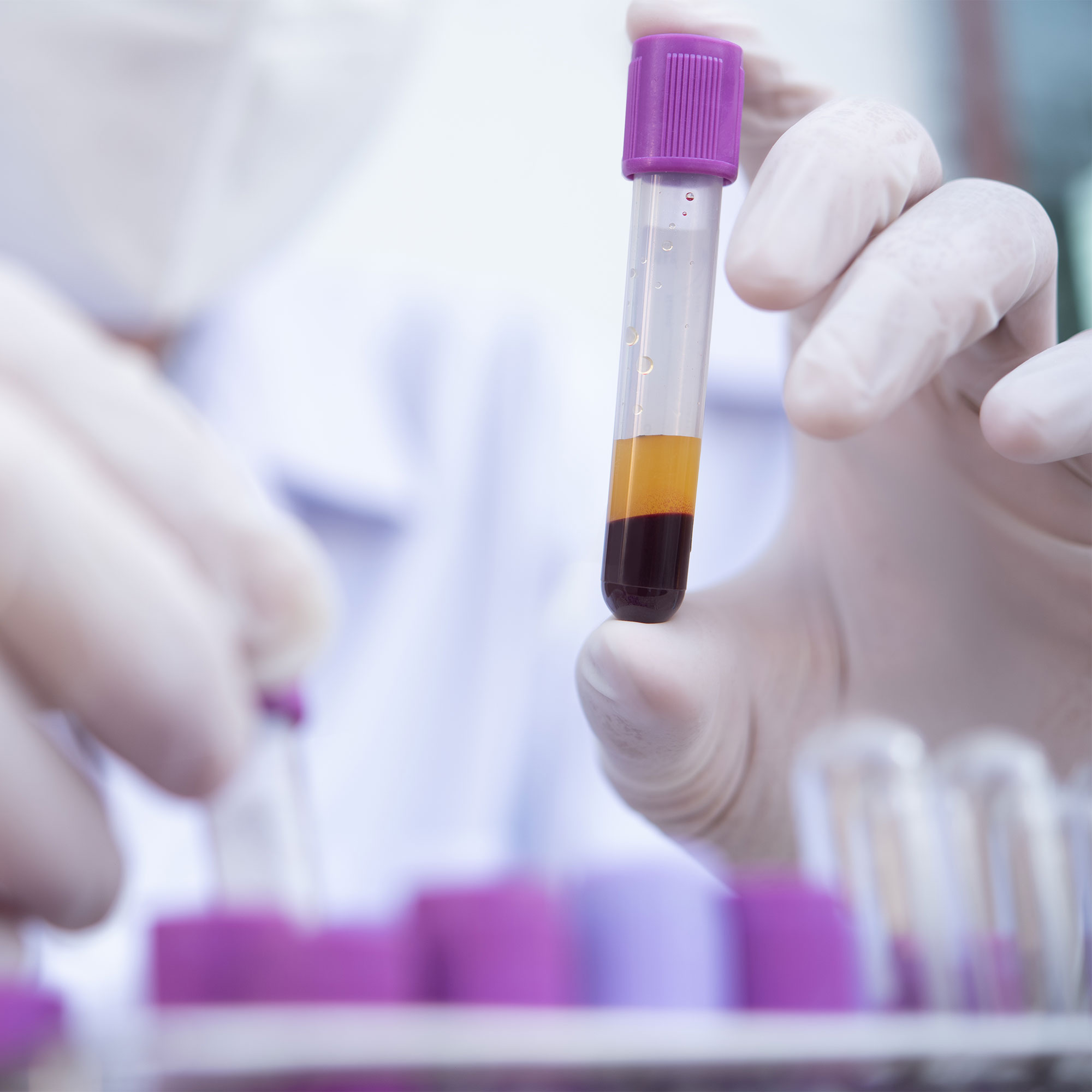 What You Need to Know About ITP