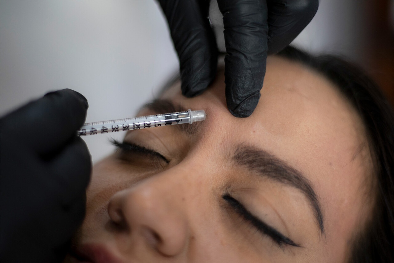 Headache After Botox: Causes, Treatment and More