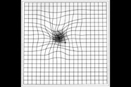 Tests For Age related Macular Degeneration