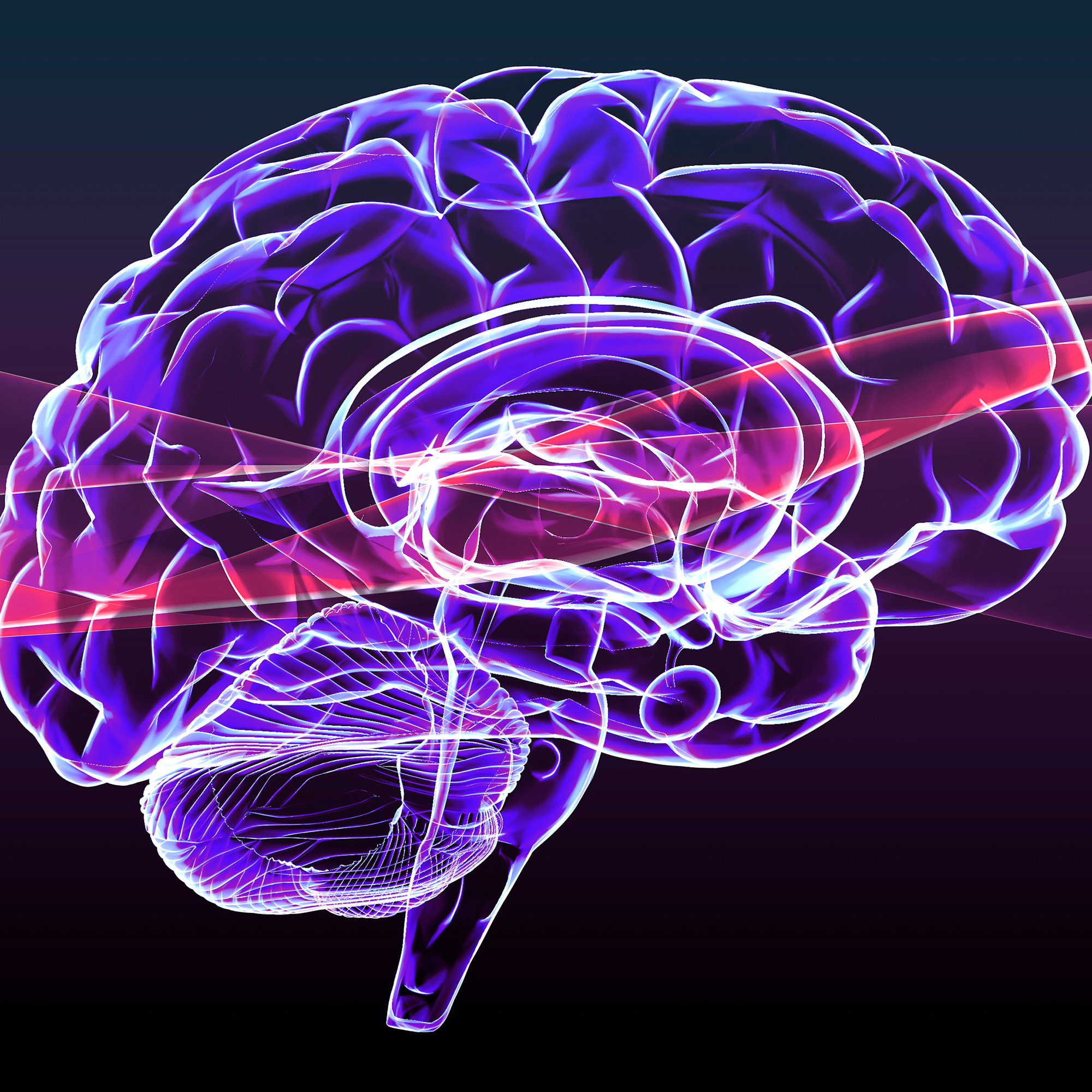 Explaining the “Psychosis Spectrum” in Parkinson’s Disease