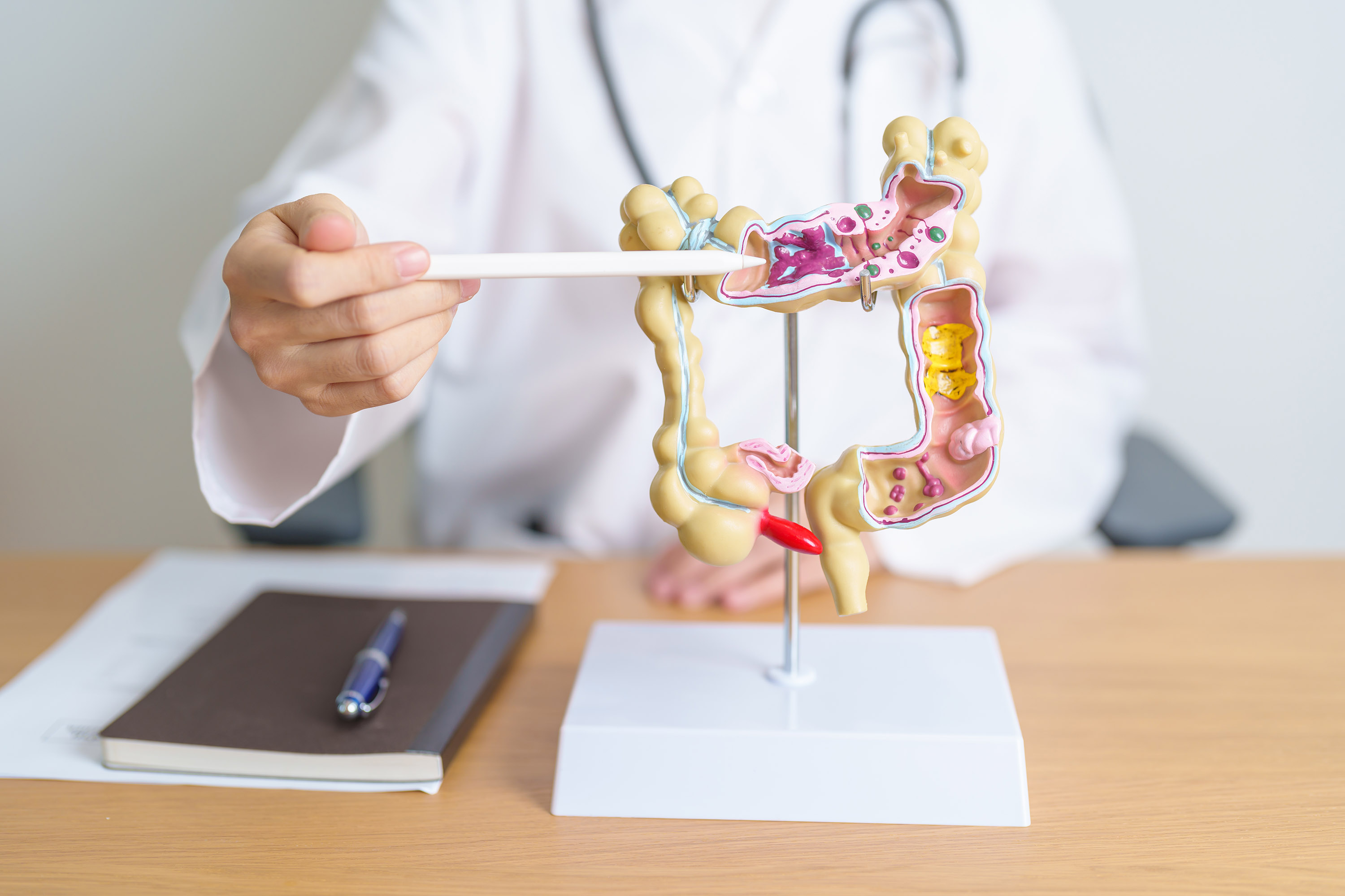 Types of Ulcerative Colitis: A Quick Overview