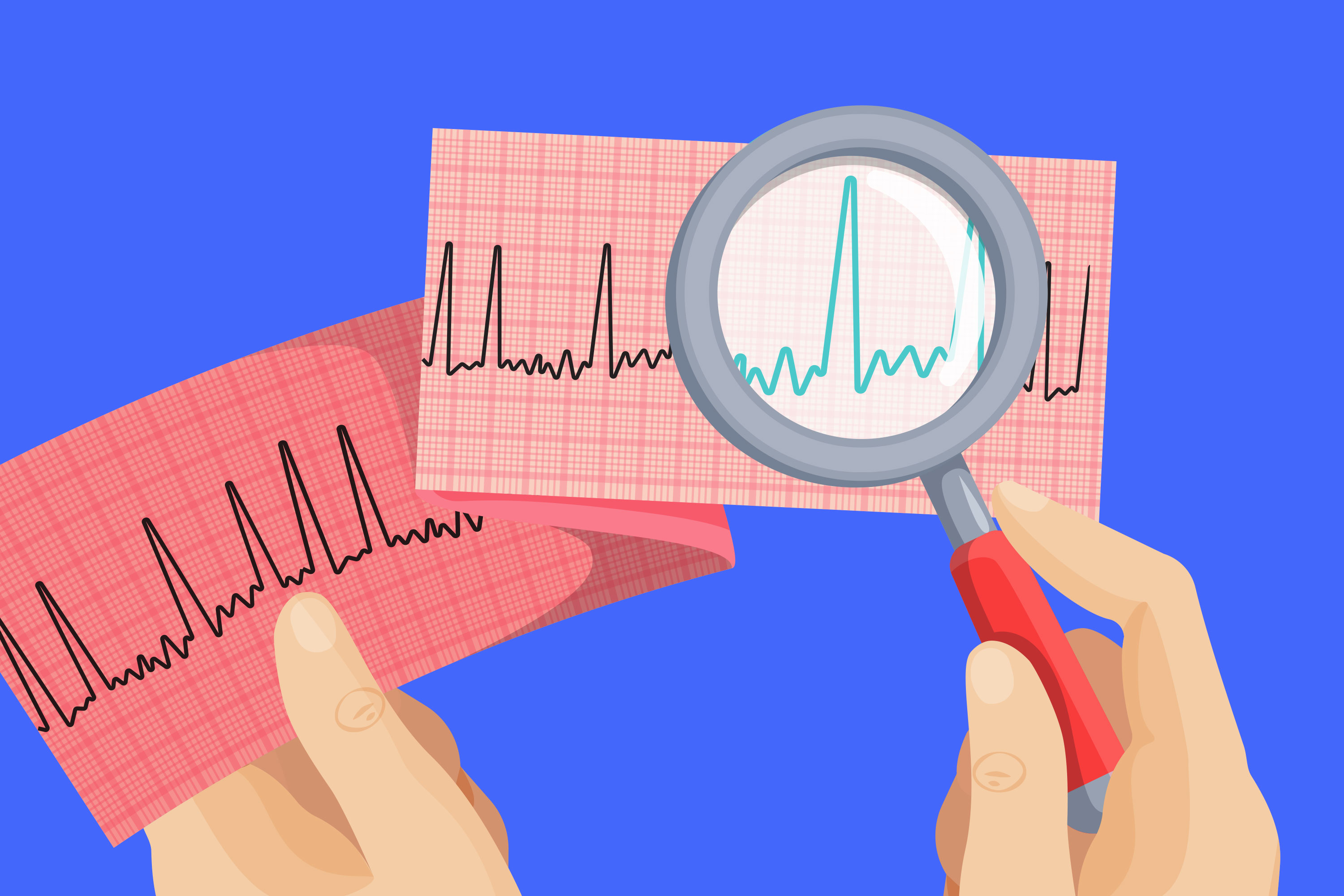 ECG/EKG Results Explained: Visual Guide