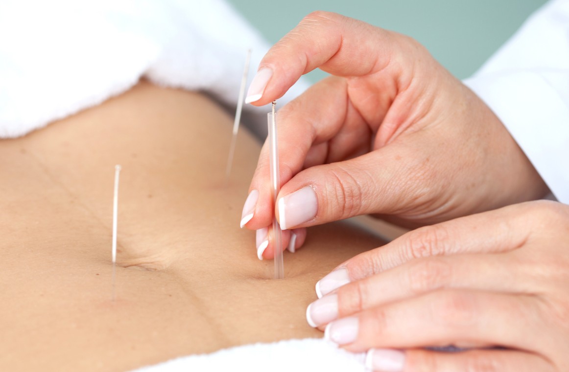 Acupuncture for Depression: Could Ancient Remedy Work for You?