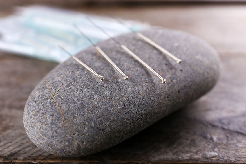 Acupuncture for Back Pain: Is It Effective?