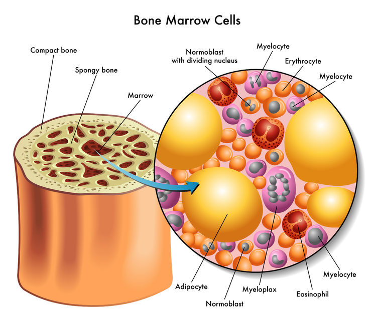 Normal Bone Marrow Cells