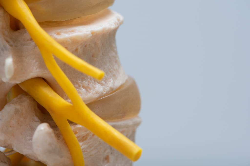 Cervical Epidural Steroid Injections: Injections for Neck Pain