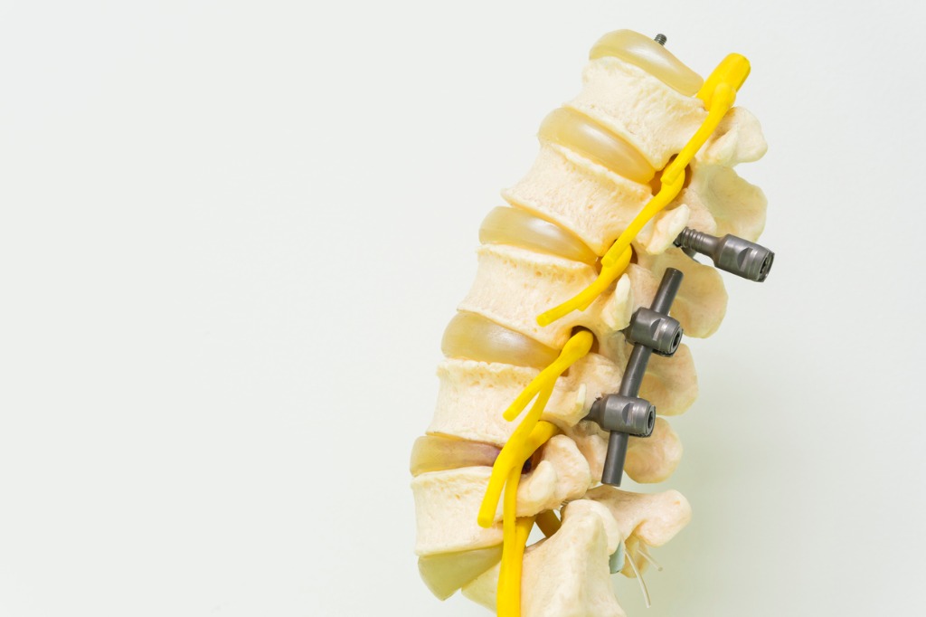Degenerative Disc Disease Center | Treatments, Symptoms, Causes