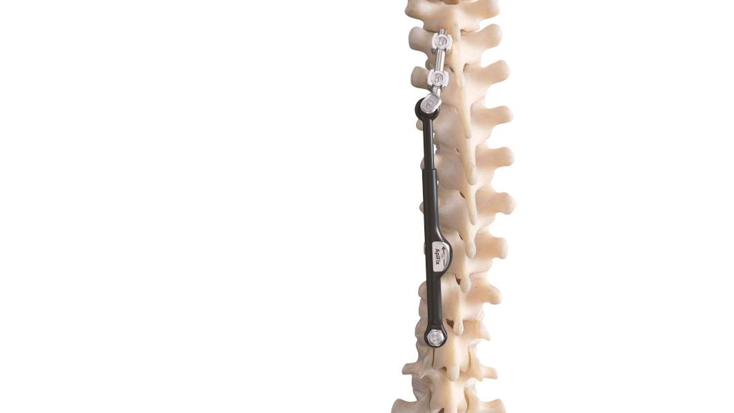 Two Scoliosis Surgery Options that Aren’t Fusion