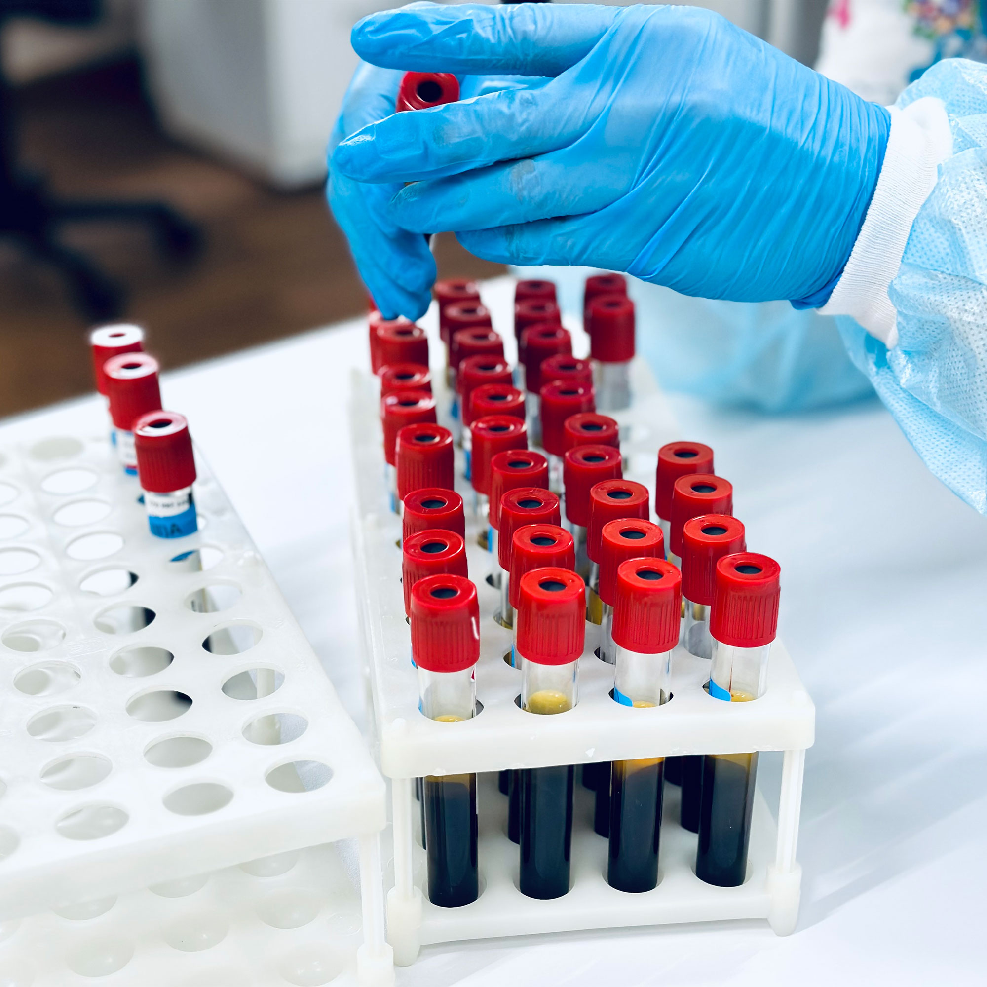 8 Things to Know About Autoantibody Testing for T1D