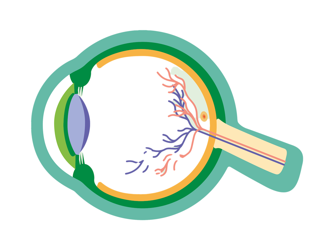 Presbyopia Explained: Meaning, Glasses & Treatment | Specsavers UK