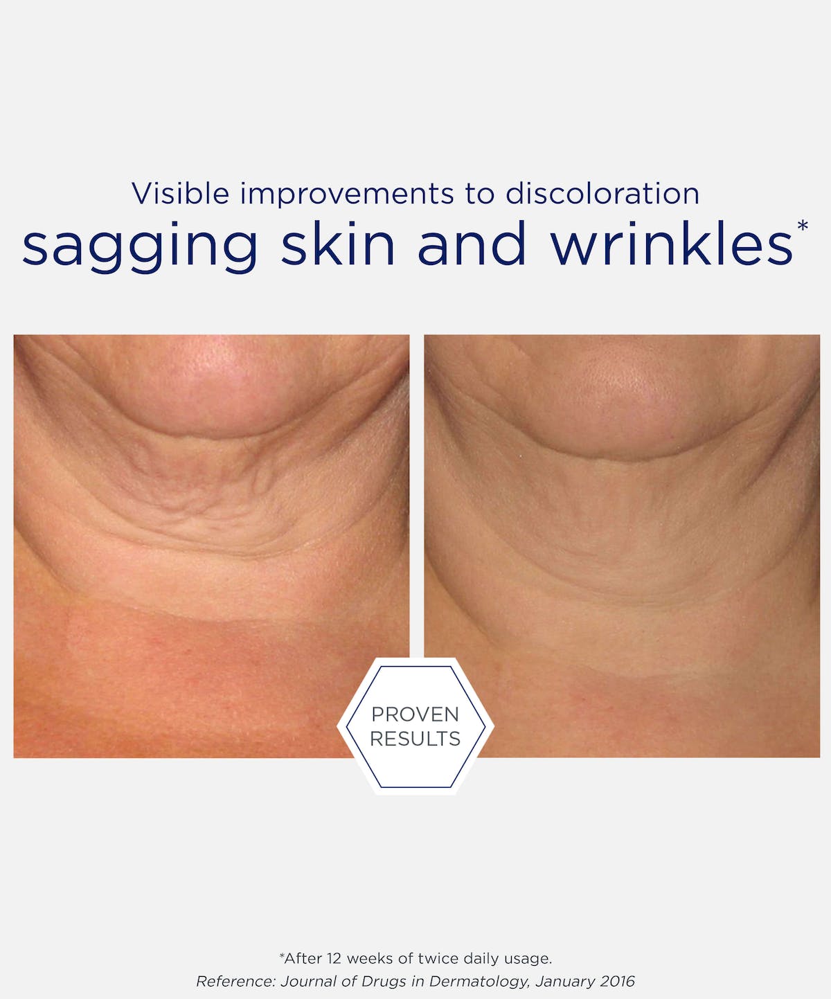 Skin Active Triple Firming Neck Cream | NEOSTRATA® Australia