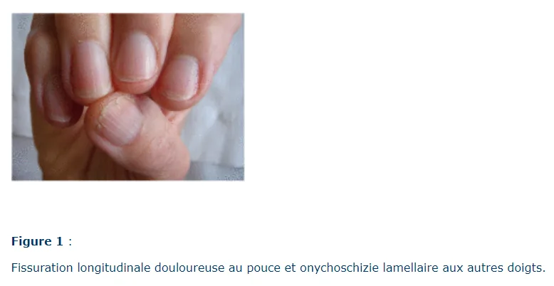 Structure et Formation de l'Ongle